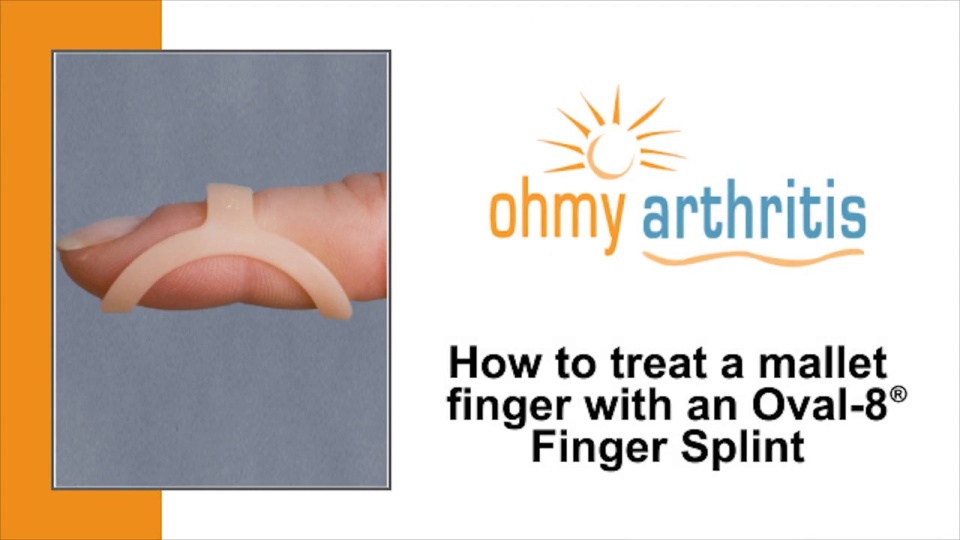 Oval-8 Finger Splints Videos | Oh My Arthritis