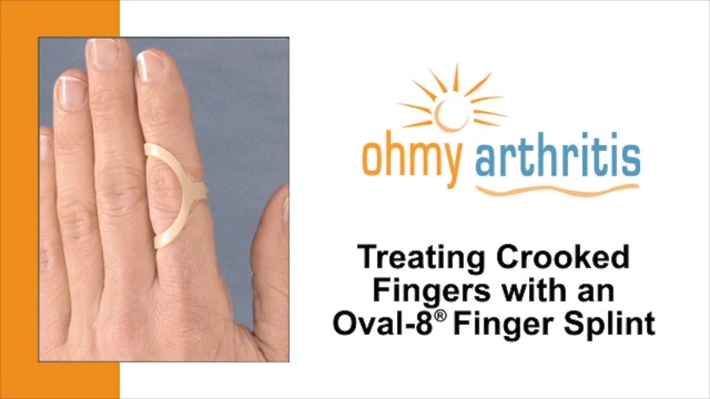 Oval-8 Finger Splints Videos | Oh My Arthritis
