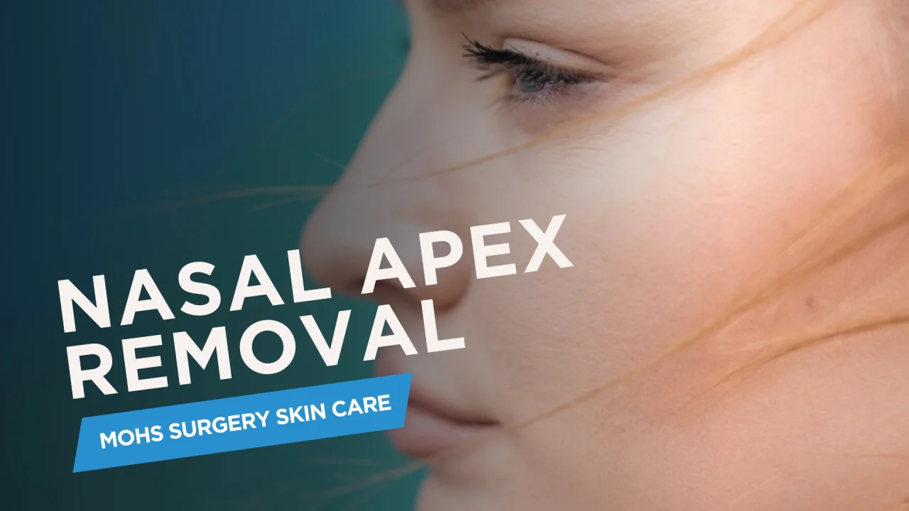 Mohs Surgery for Skin Cancer Before + After Photos Testimonial