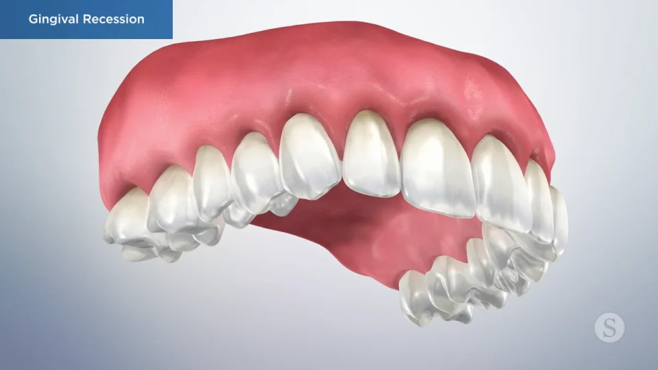 Amanda Crew Teeth Fixed
