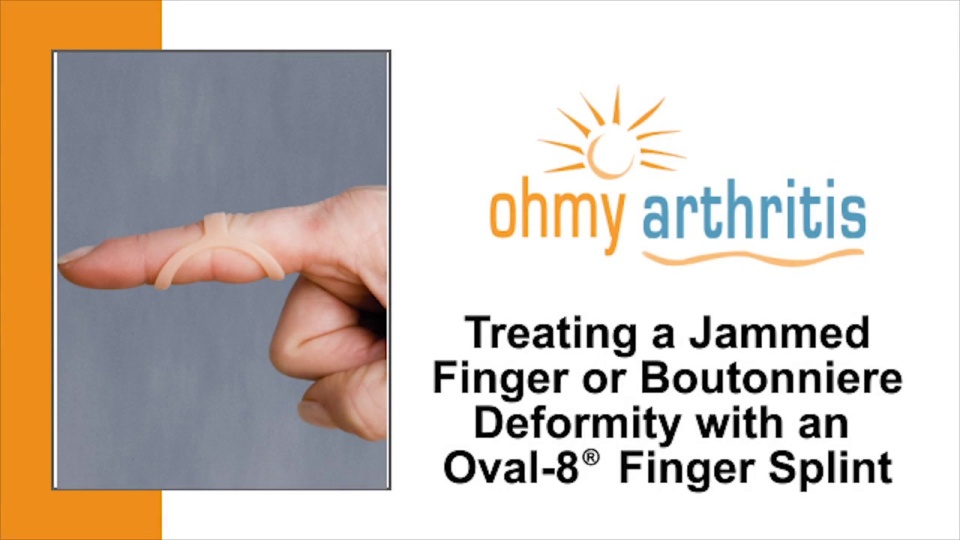 Oval-8 Finger Splints Videos | Oh My Arthritis